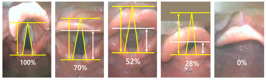 Machine Learning Predictions and Identifying Key Predictors for Safer ...