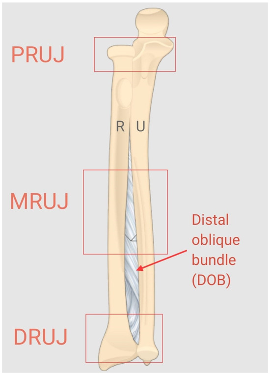 Advancements in Diagnosis and Management of Distal Radioulnar Joint ...