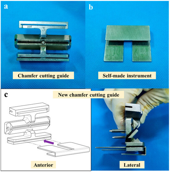 Surgical Technique for Complementing Robotic-Assisted Total Knee ...
