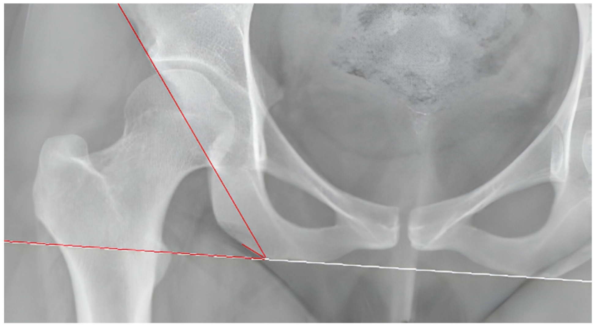 Unveiling the Hidden Links: Anatomical and Radiological Insights into ...