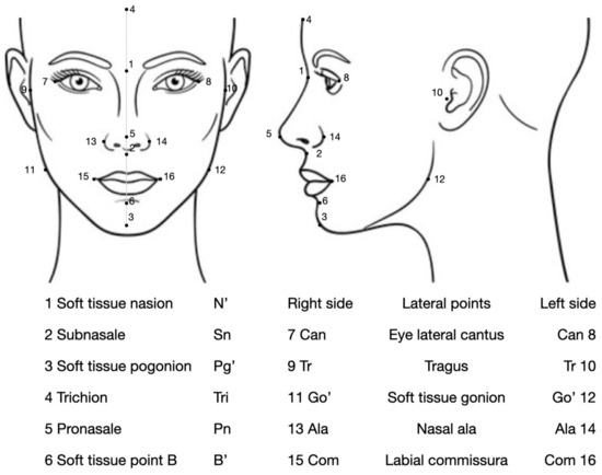 Soft Tissue Facial Morphology in Growing Patients with Different ...