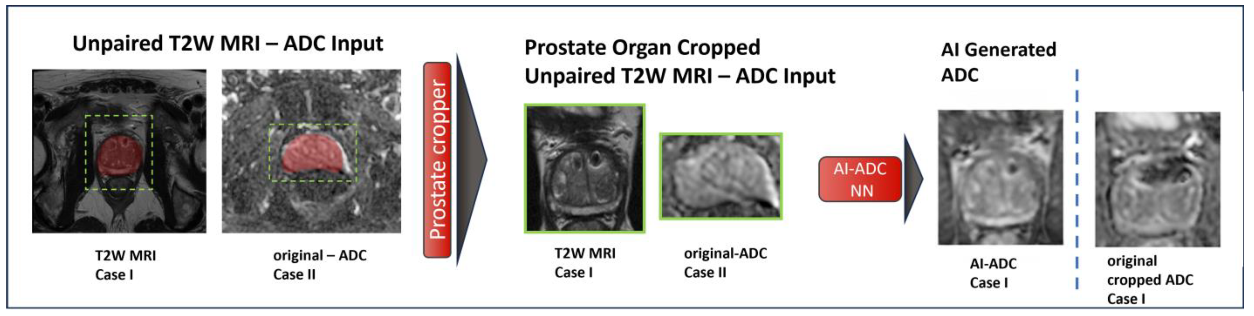 AI-ADC: Channel and Spatial Attention-Based Contrastive Learning to Generate ADC Maps from T2W ...