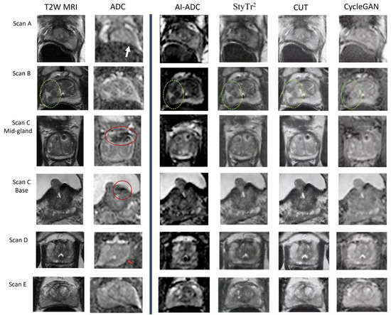 AI-ADC: Channel and Spatial Attention-Based Contrastive Learning to ...