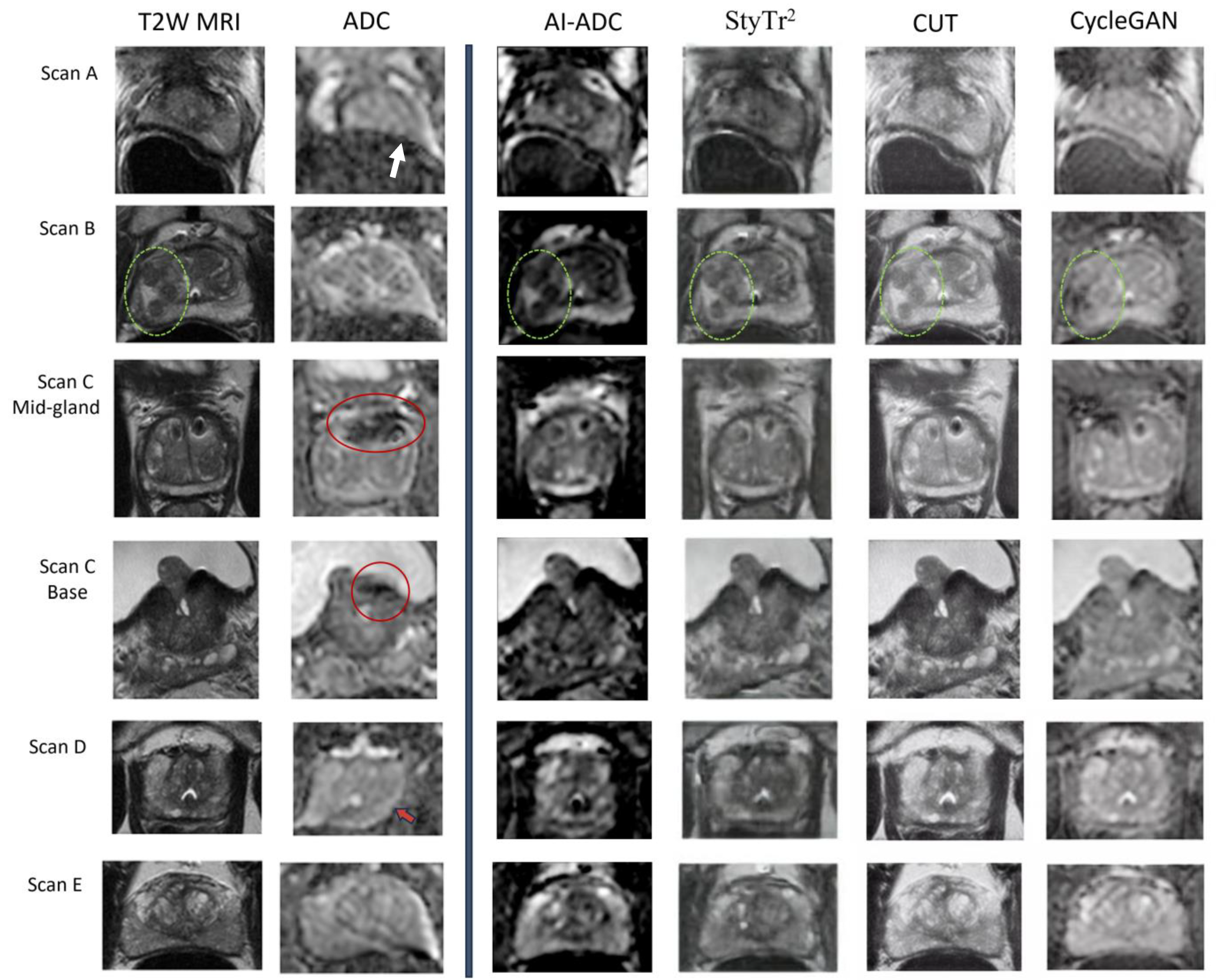 AI-ADC: Channel and Spatial Attention-Based Contrastive Learning to Generate ADC Maps from T2W ...