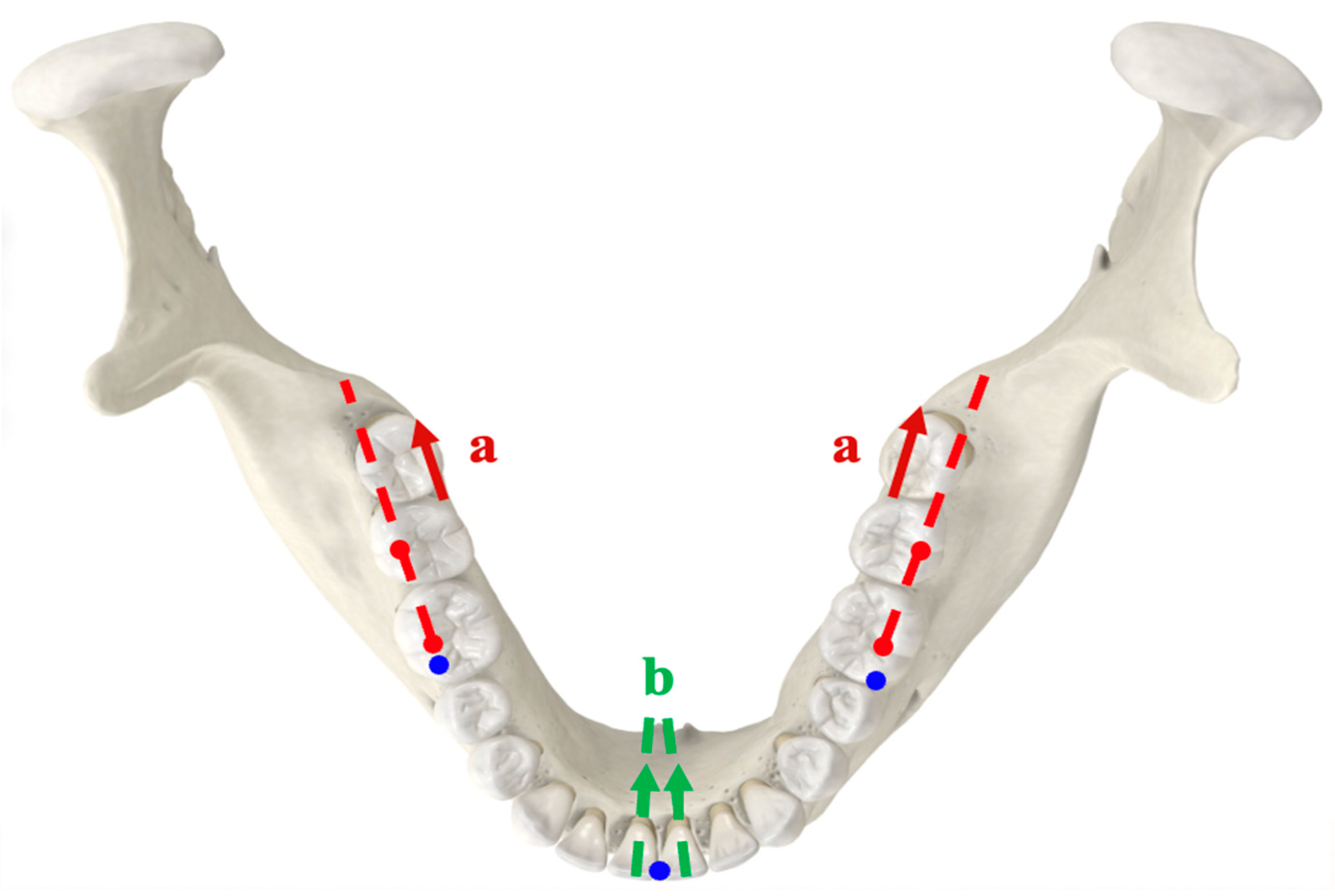 The Three-Dimensional Investigation of the Radiographic Boundary of ...