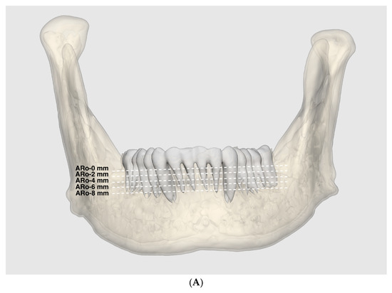 The Three-Dimensional Investigation of the Radiographic Boundary of ...
