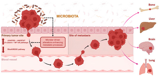 Intratumoral Microbiota: Insights from Anatomical, Molecular, and ...