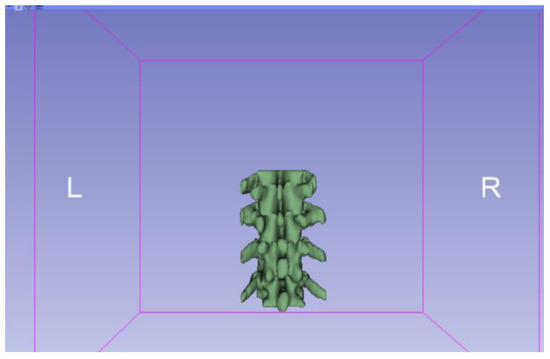 Protocol for Converting DICOM Files to STL Models Using 3D Slicer and ...