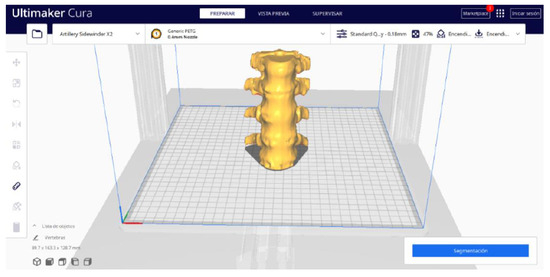 Protocol for Converting DICOM Files to STL Models Using 3D Slicer and ...