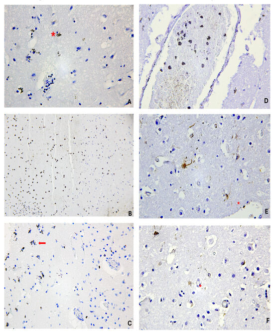 Vimentin and p53 Immunoreactivity in Cases of Traumatic Brain Injury
