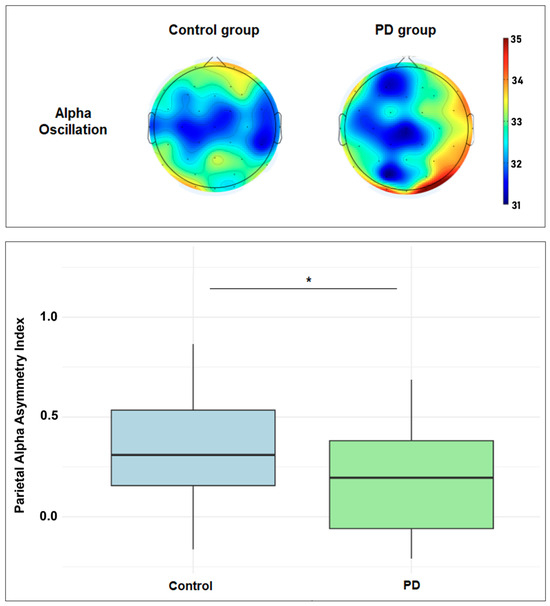 Resting-State EEG Alpha Asymmetry as a Potential Marker of Clinical ...