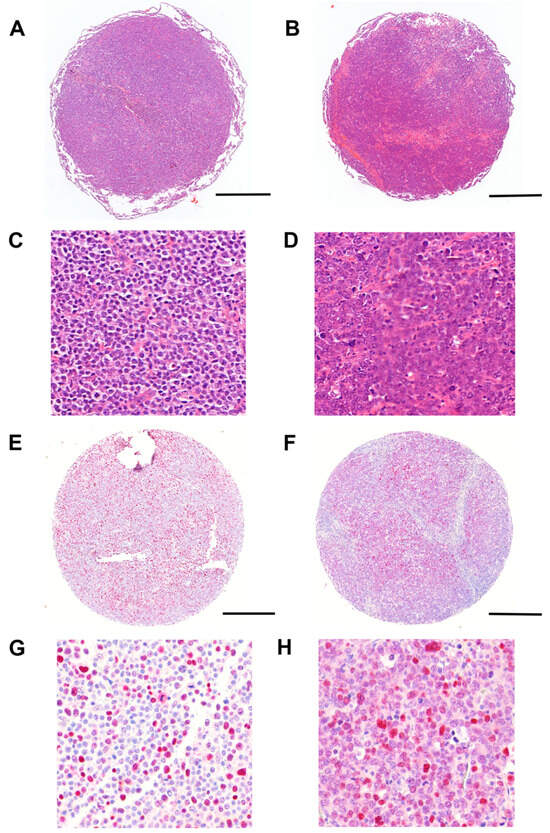 Gene Expression Profiling Provides an Improved Characterization of ...