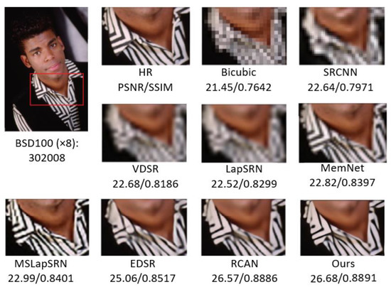 Fusion Objective Function on Progressive Super-Resolution Network