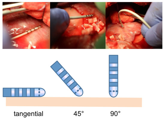 Journal of Vascular Diseases | An Open Access Journal from MDPI
