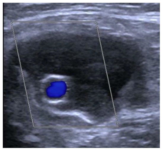 JVD | December 2022 - Browse Articles