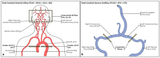 Cerebral Arterial Inflow and Venous Outflow Assessment Using 4D Flow ...