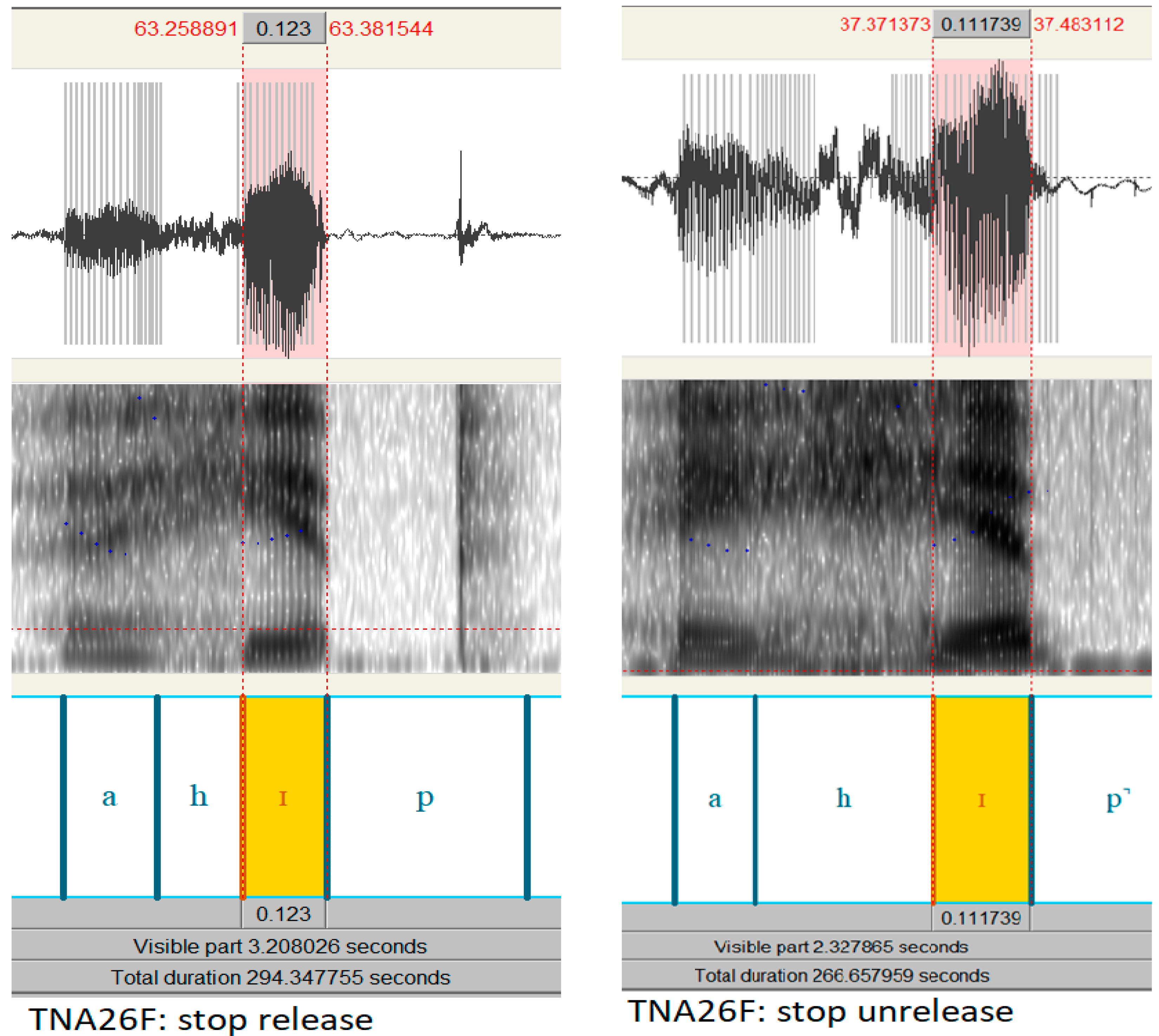 Could You Say [læp˺ tɒp˺]? Acquisition of Unreleased Stops by Advanced ...