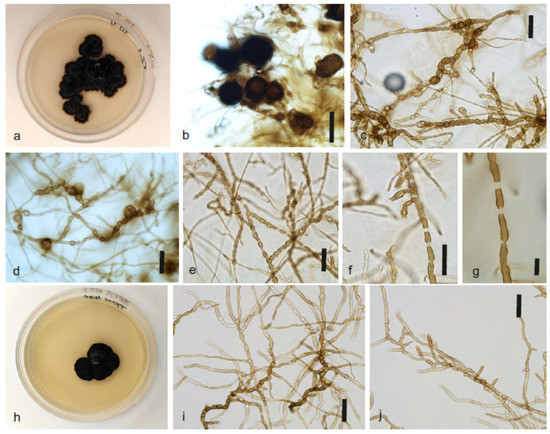 Roof-Inhabiting Cousins of Rock-Inhabiting Fungi: Novel Melanized ...