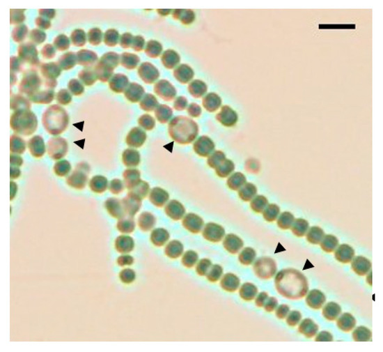 Anabaena Under Microscope Biology