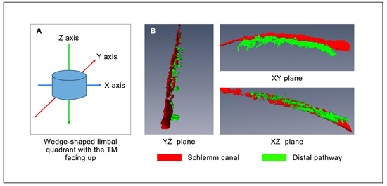Effects of Schlemm’s Canal Expansion: Biomechanics and MIGS Implications