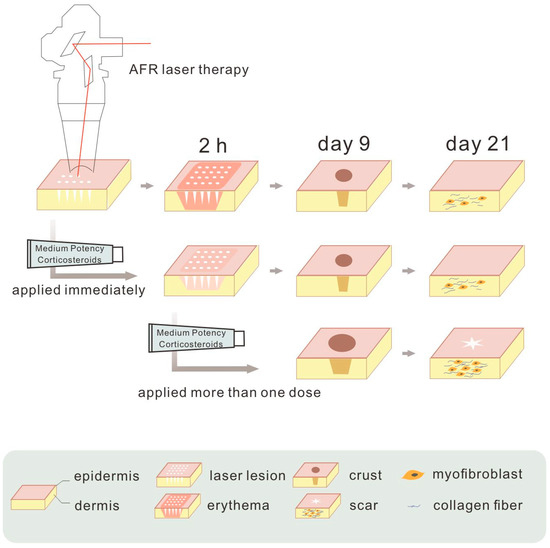 The Optimal Application of Medium Potency Topical Corticosteroids in ...