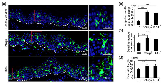 Morphological Alterations and Increased S100B Expression in Epidermal ...