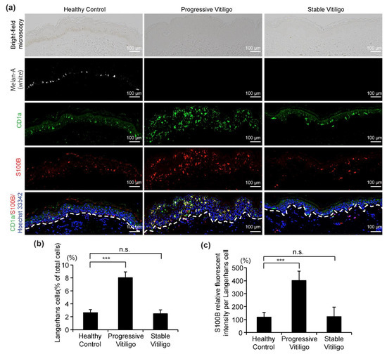 Morphological Alterations and Increased S100B Expression in Epidermal ...
