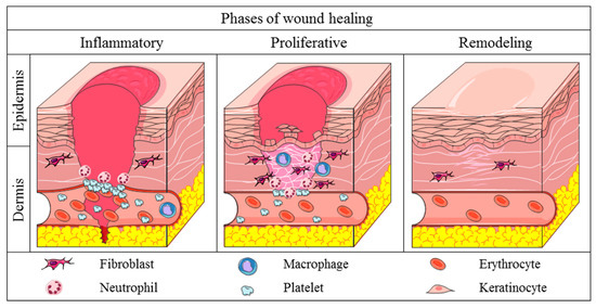 Cutaneous Wound Healing: An Update from Physiopathology to Current ...