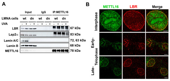 Localization of METTL16 at the Nuclear Periphery and the Nucleolus Is ...