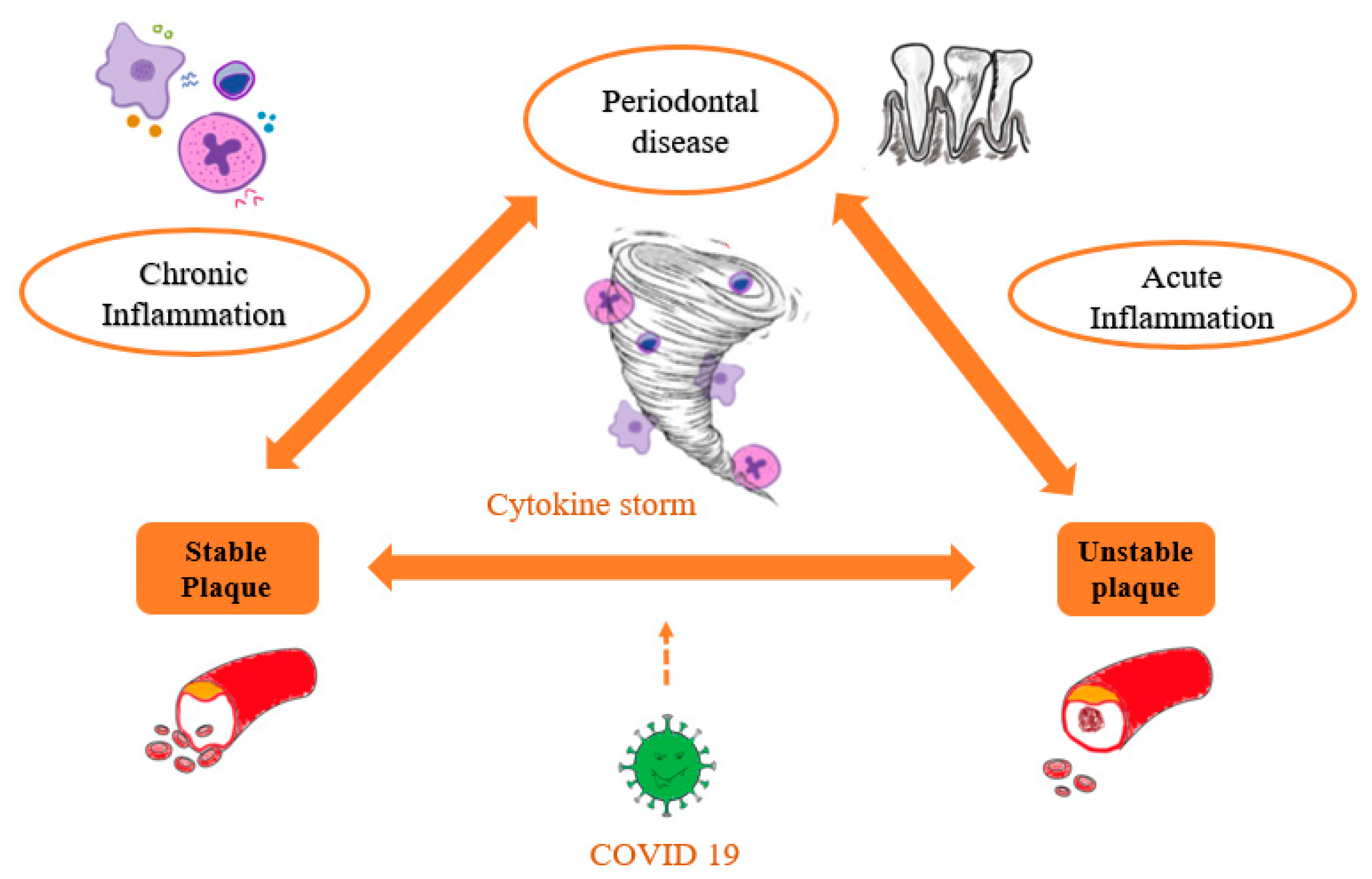 Is There a Link between COVID-19 Infection, Periodontal Disease and Acute Myocardial Infarction?