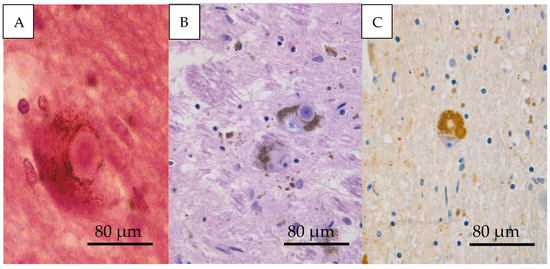 Examining the Toxicity of α-Synuclein in Neurodegenerative Disorders