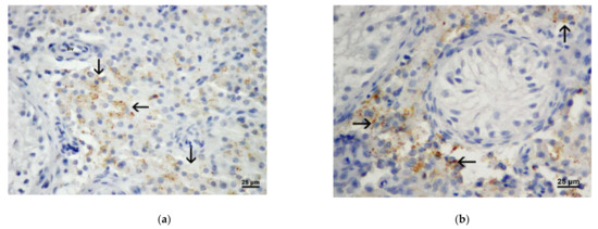 Life Free Full Text Leydig Cells In Patients With Non Obstructive