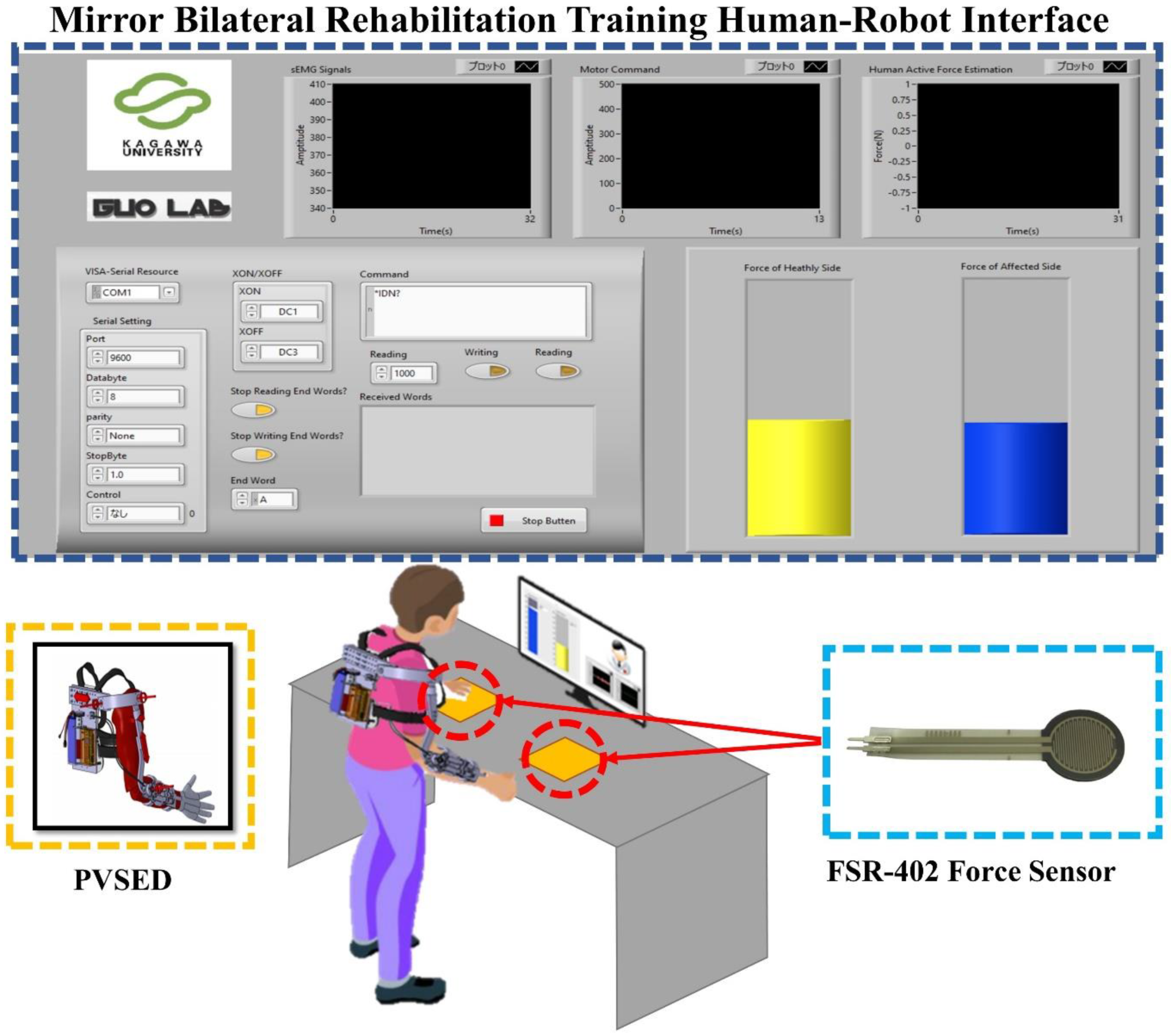 A Mirror Bilateral Neuro-Rehabilitation Robot System with the sEMG ...