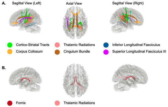 Elevated Systemic Inflammation Is Associated with Reduced Corticolimbic ...