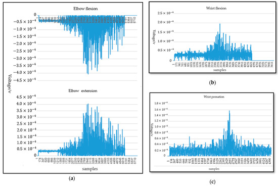 sEMG-Based Motion Recognition of Upper Limb Rehabilitation Using the Improved Yolo-v4 Algorithm