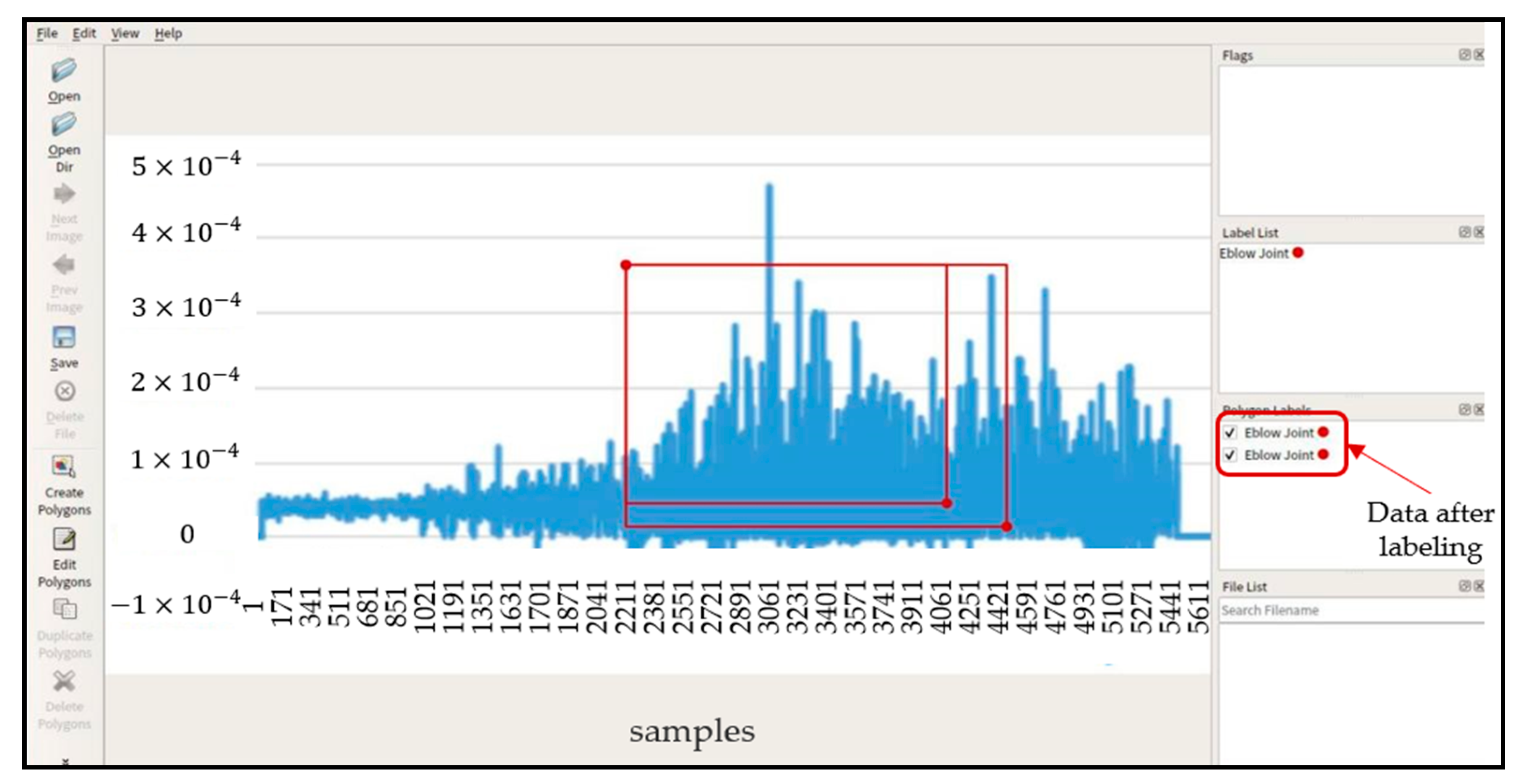 sEMG-Based Motion Recognition of Upper Limb Rehabilitation Using the Improved Yolo-v4 Algorithm