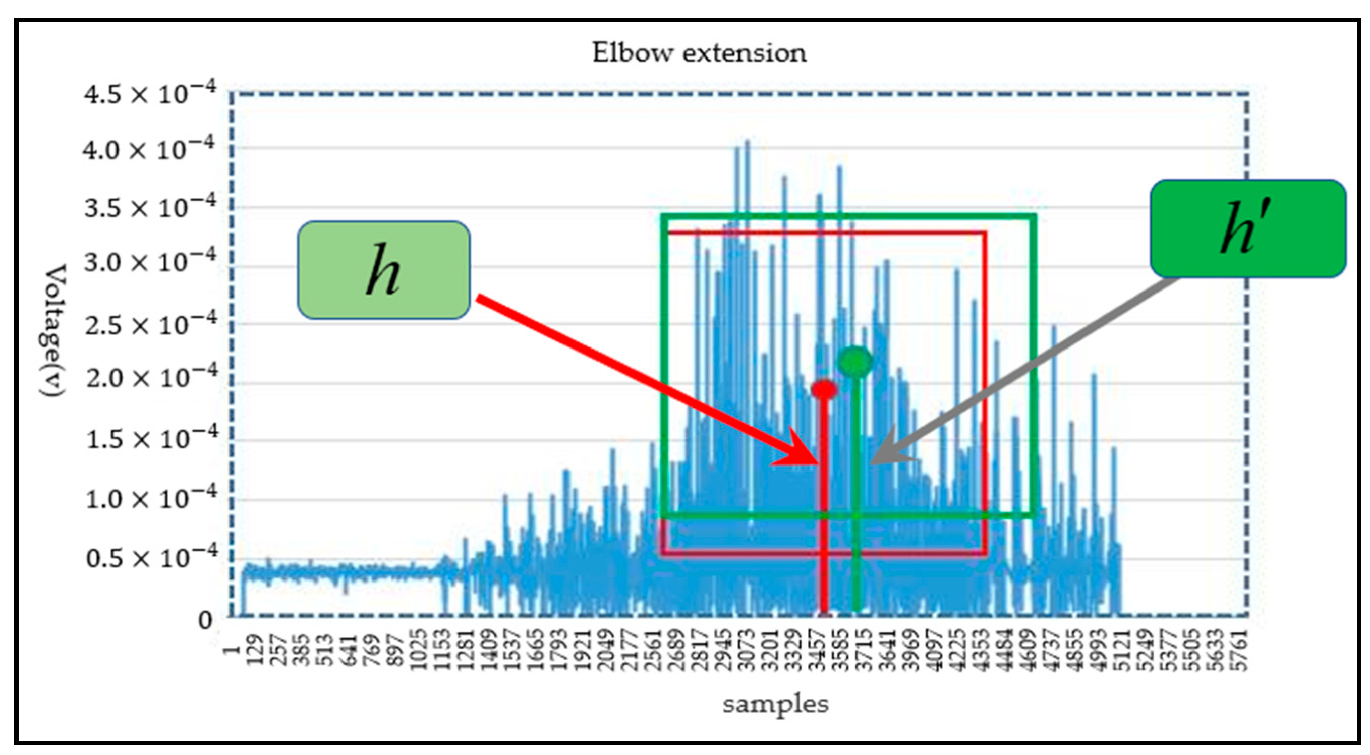 sEMG-Based Motion Recognition of Upper Limb Rehabilitation Using the Improved Yolo-v4 Algorithm