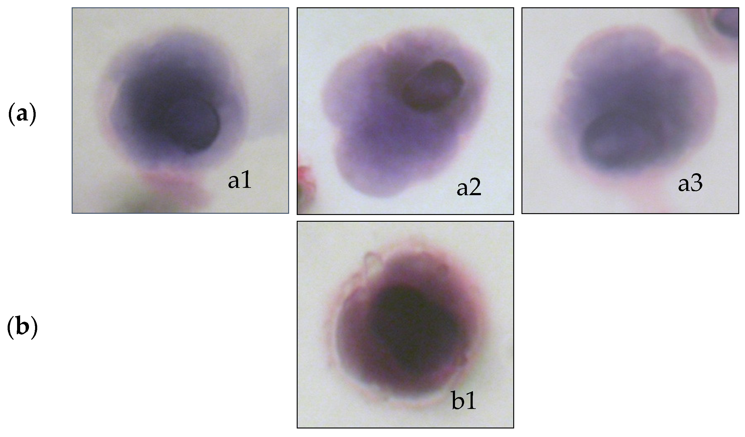 Predictive Value of Circulating Tumor Cells Detected by ISET® in ...