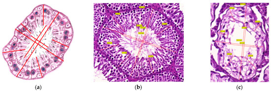 Testis Slide Interstitial Cells