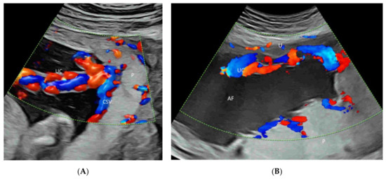 Update on Color Flow Imaging in Obstetrics