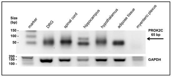 Identification and Characterization of a New Splicing Variant of ...