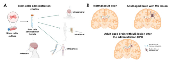 Life | Free Full-Text | The Integration of Cell Therapy and ...