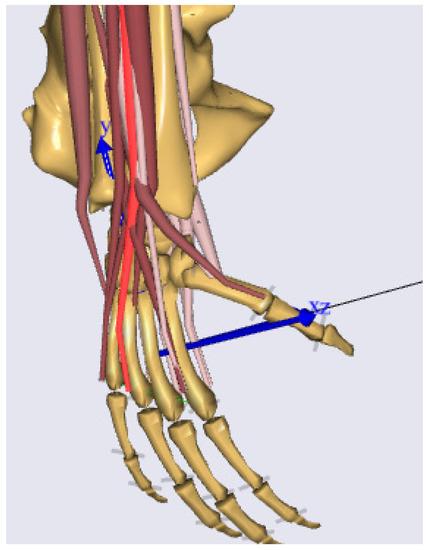 Musculoskeletal Modeling of the Wrist via a Multi Body Simulation