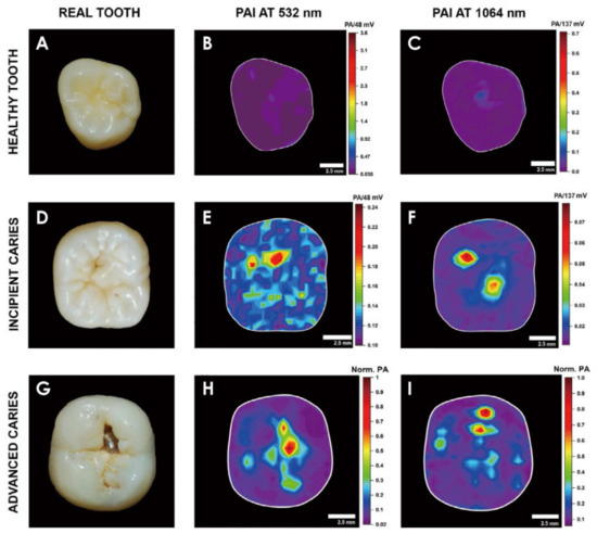 Photoacoustic Imaging in Biomedicine and Life Sciences