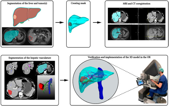 Integration of Three-Dimensional Liver Models in a Multimodal Image ...