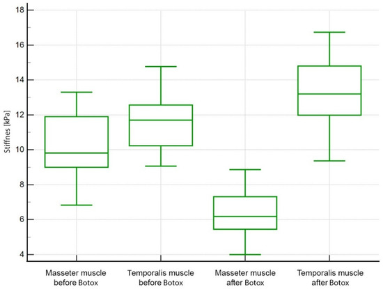 Life | Free Full-Text | Botox Therapy for Hypertrophy of the Masseter ...