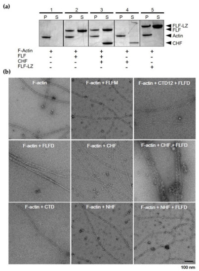 Structural Analysis of Human Fascin-1: Essential Protein for Actin ...