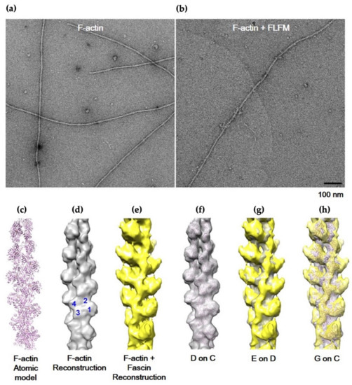 Structural Analysis of Human Fascin-1: Essential Protein for Actin ...