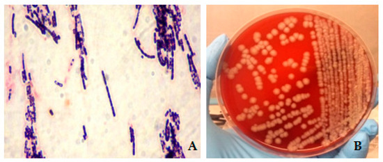 An Outbreak of Human Systemic Anthrax, including One Case of Anthrax ...