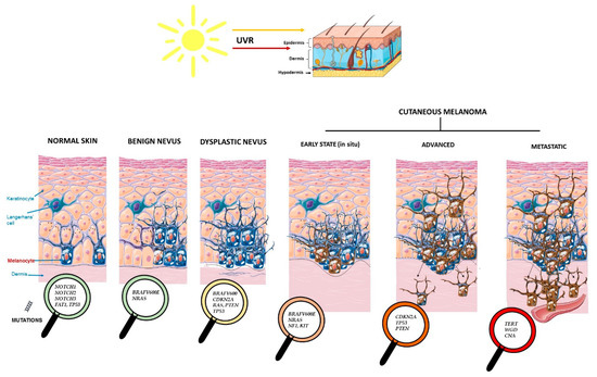 UV-Induced Somatic Mutations Driving Clonal Evolution in Healthy Skin ...